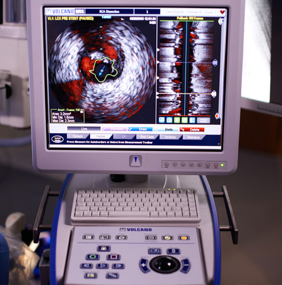 Installation of a new generation of IVUS devices in Tehran | تایماز